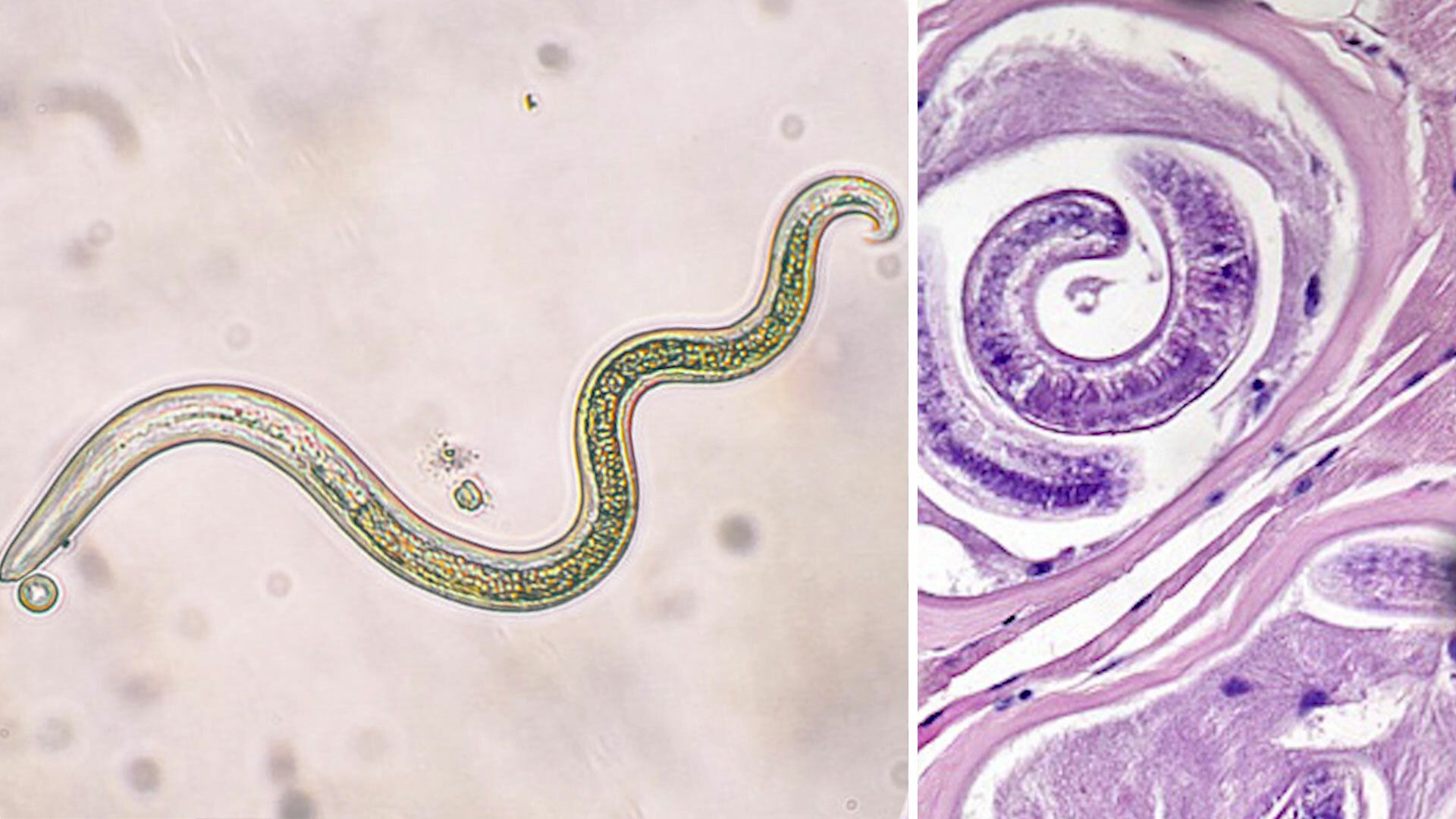 Maskparasit hittad – kan orsaka allvarlig sjukdom och död