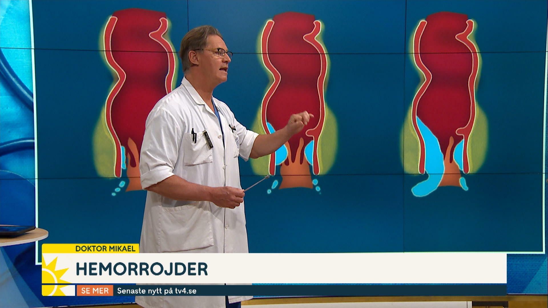 Dr Mikael om hemorrojder: Här är symtomen du ska ha kolll...