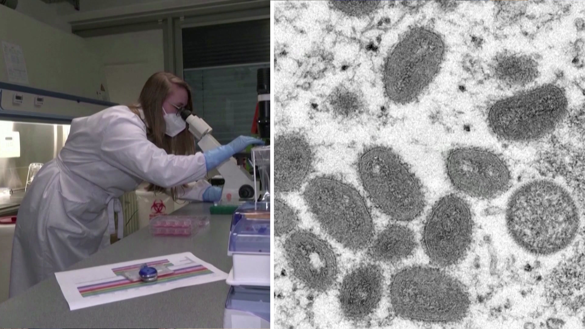 Över 700 fall av apkoppor i världen