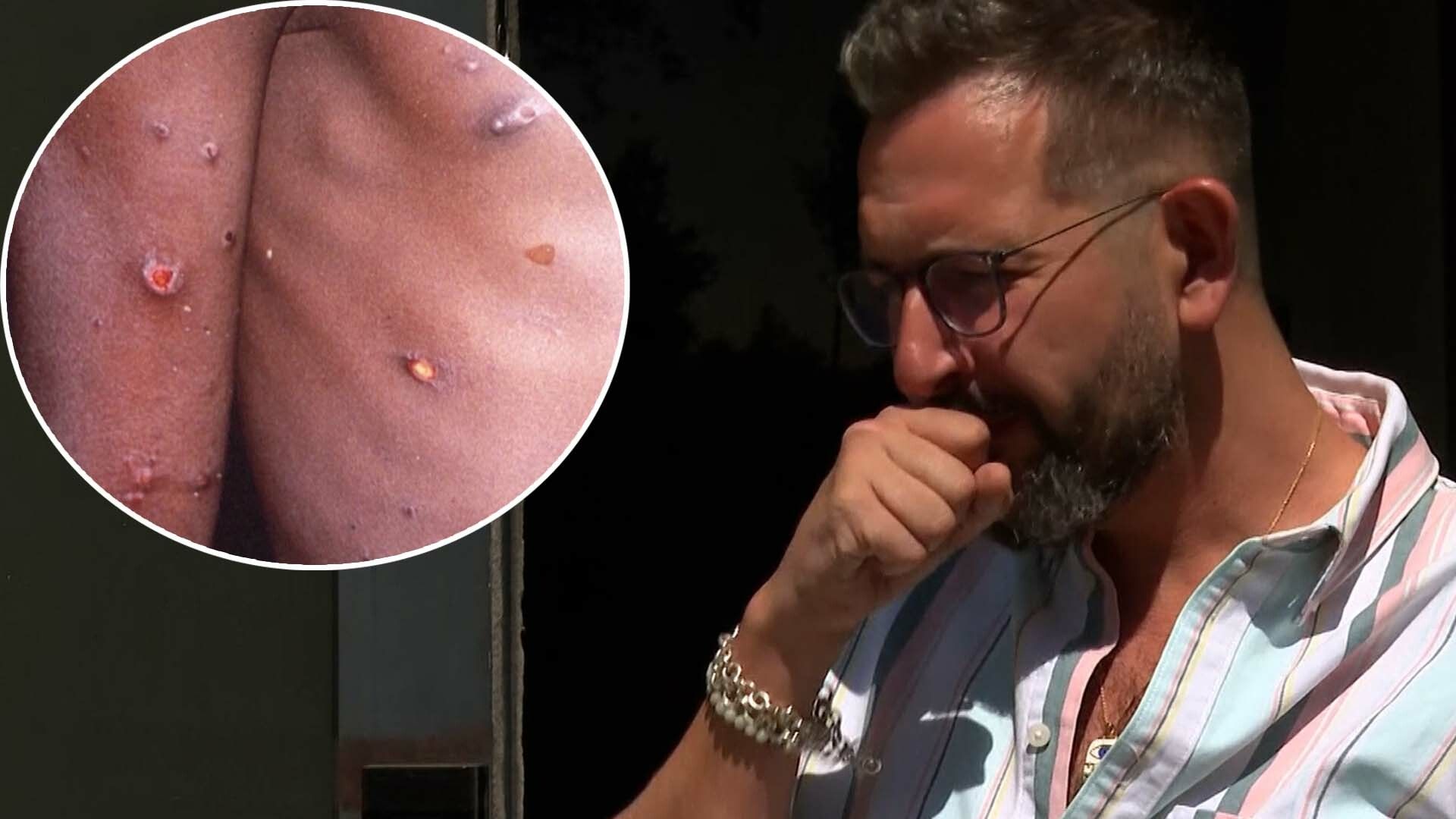 Chockbeskedet: Han hade apkoppor – men fick ingen hjälp