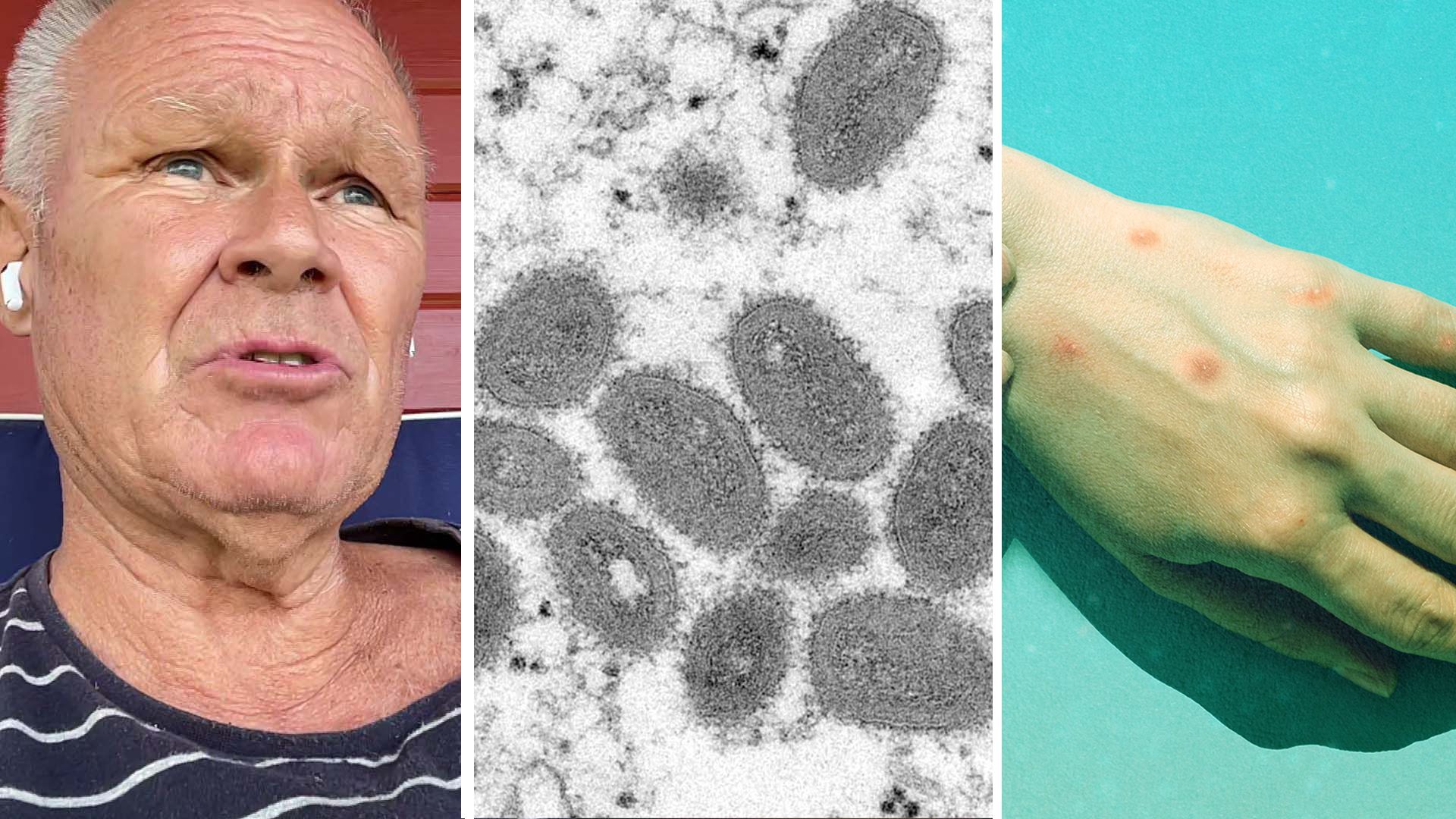 Virologen: Apkoppor kommer inte få samma spridning som covid