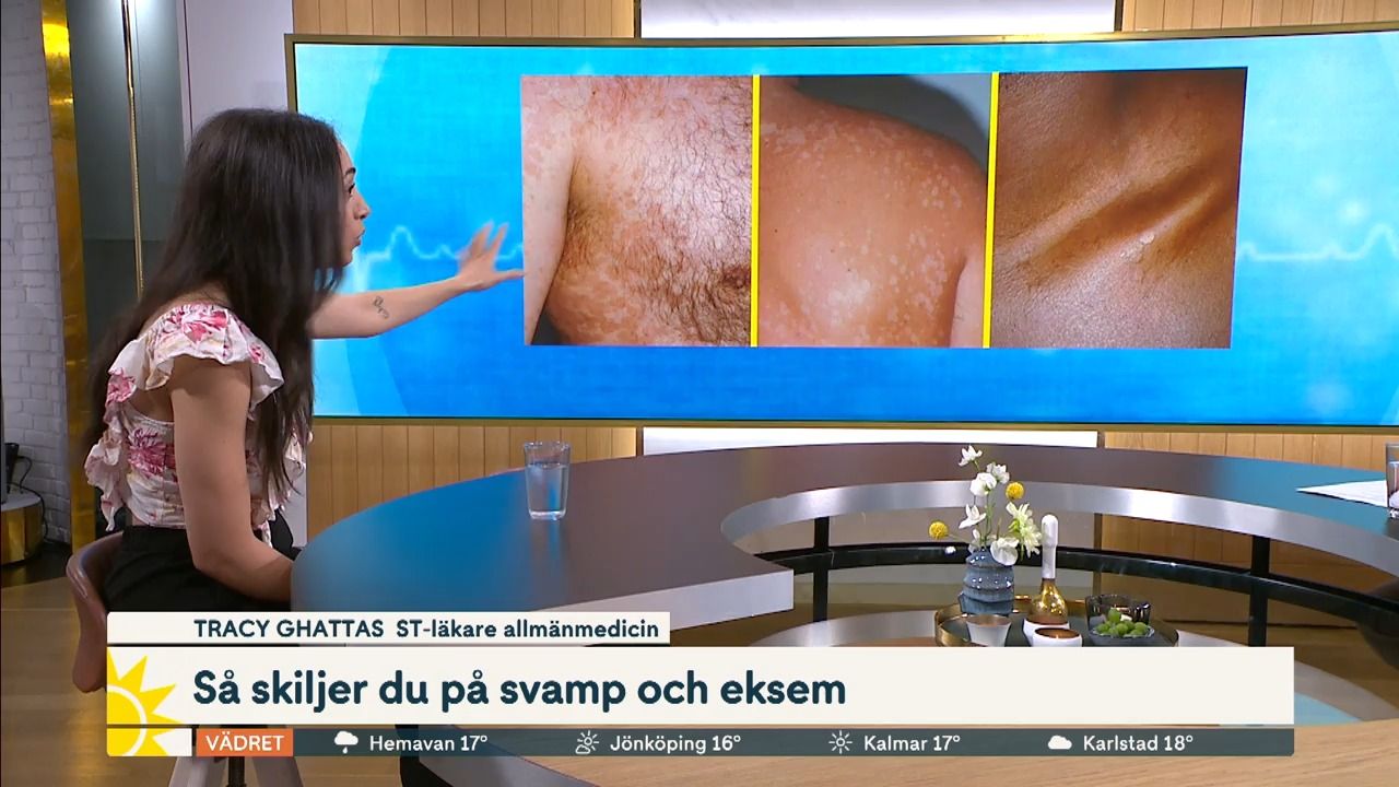 Sommardoktorn: Så undviker du svampinfektioner i sommar