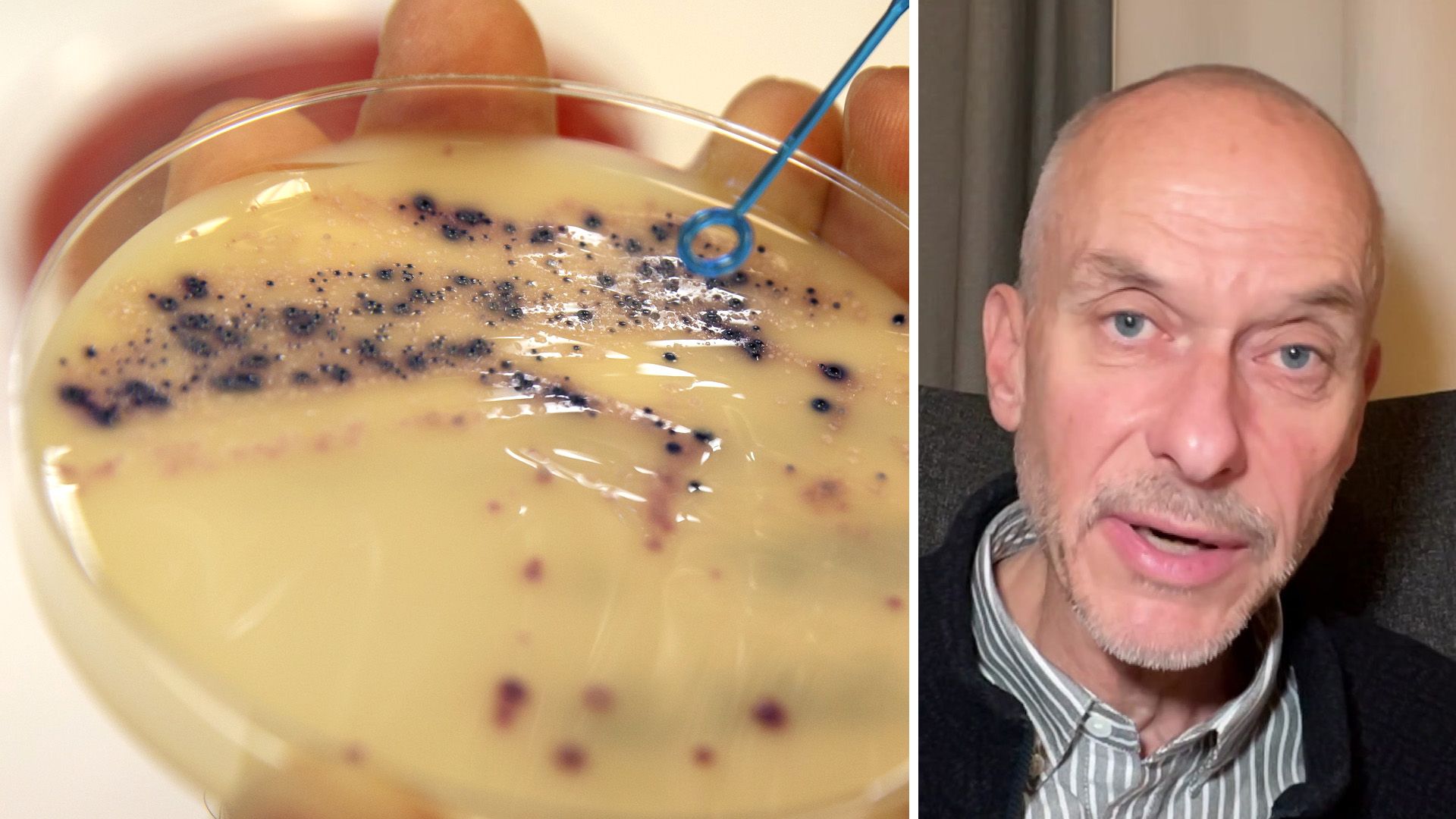 Oroande spridning av multiresistenta bakterier